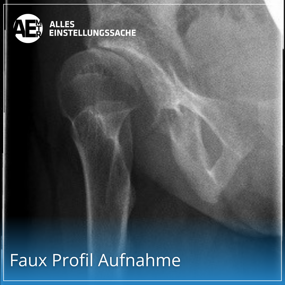 Orthopädie Spezial I Die Faux. Profil - Aufnahme – Alles Einstellungssache
